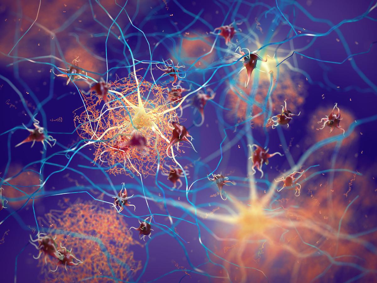 Aluminum: The Brain Toxin Found Everywhere, Ways to Remove | The Epoch ...