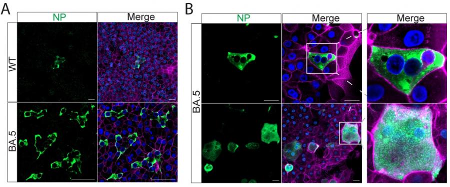 Omicron BA.5 Insights: New Model Reveals Primary Cause for High ...