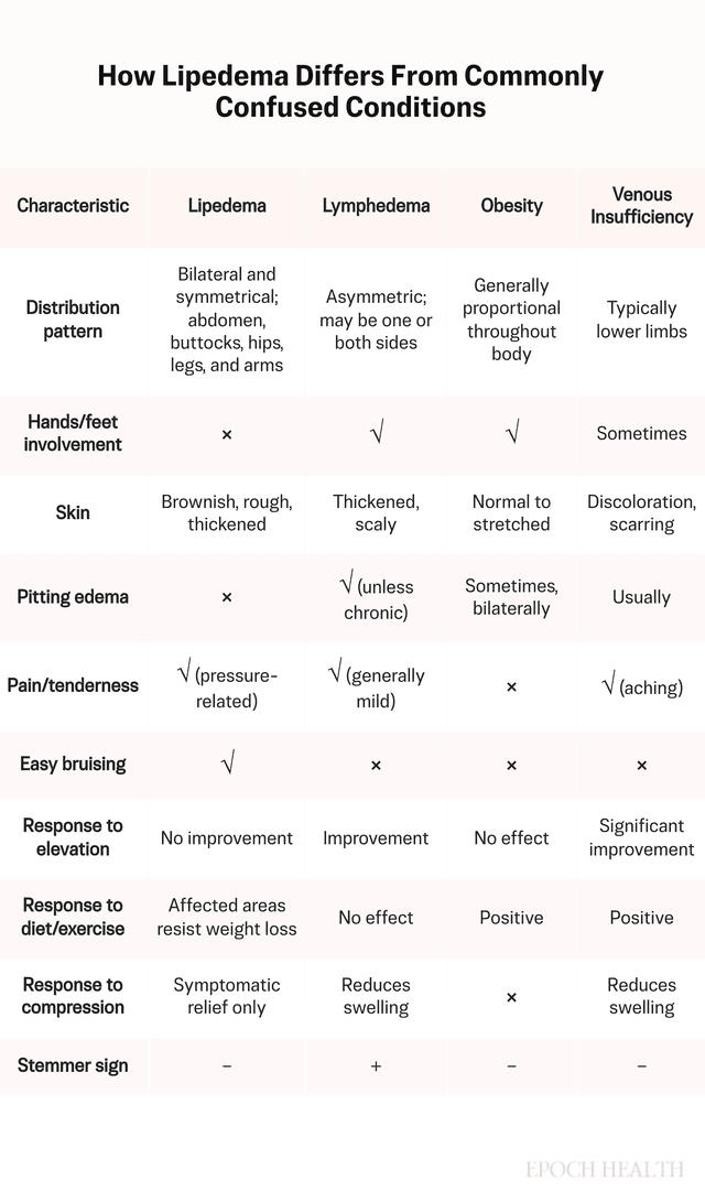 Lipedema: The Abnormal Fat Buildup Often Mistaken for Weight Gain–Here ...