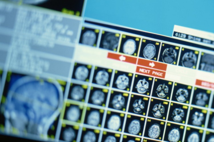 ‘Movies’ in the Mind Revealed by Brain Imaging | The Epoch Times